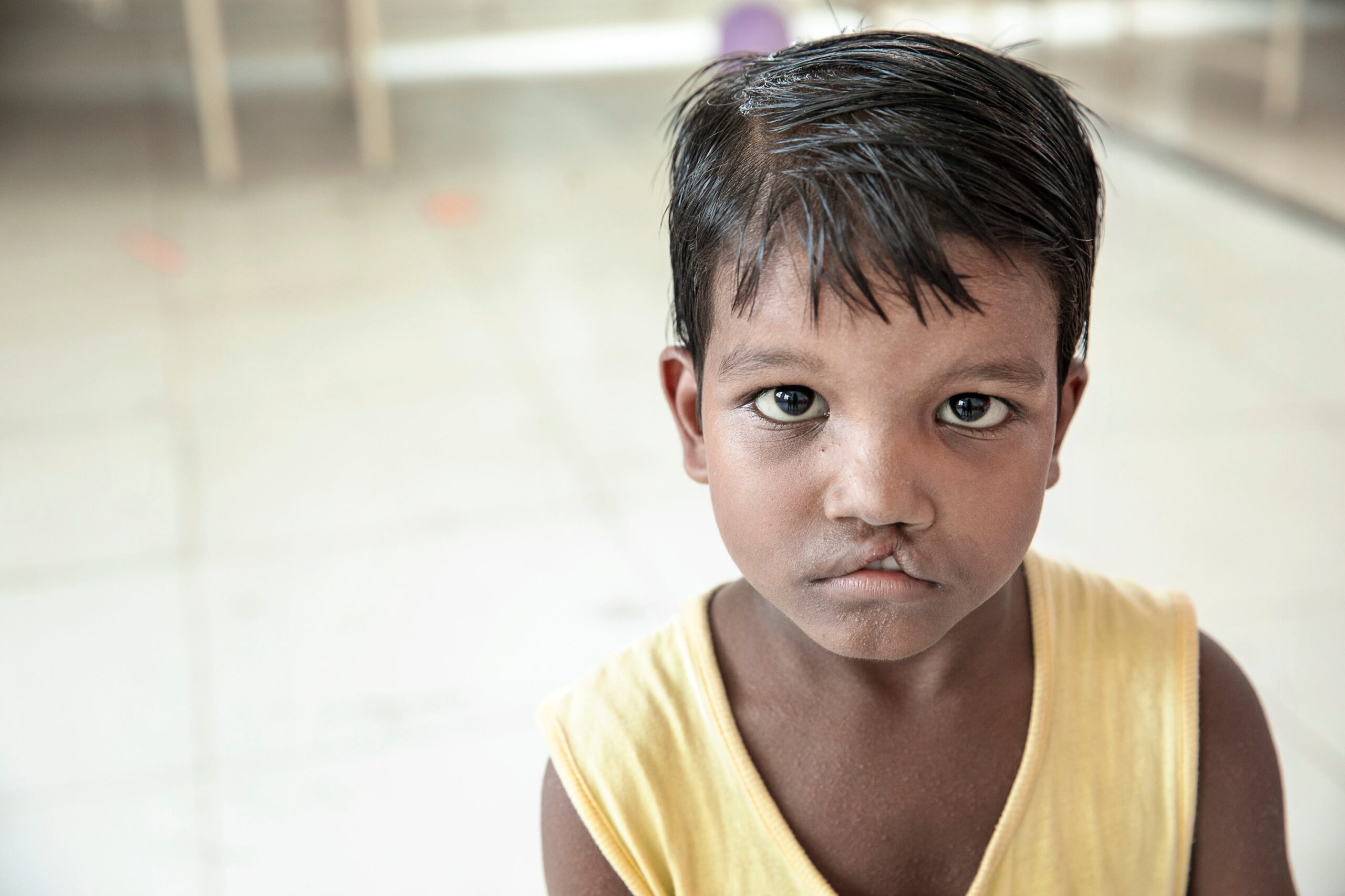 Our Cause | Operation Smile Australia